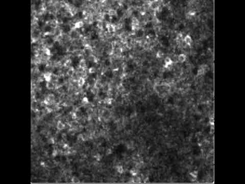 CaImAn Calcium Imaging Analysis Pipeline for treatment 1/3