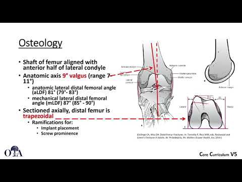 Distal femur fractures – OrthoClips