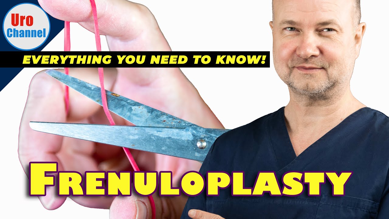 Solution for injuries to the frenulum during sex | UroChannel