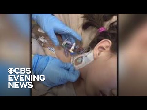 CDC issues health advisory for mystery illness killing children
