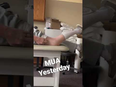 MUA Yesterday | Total Knee Replacement