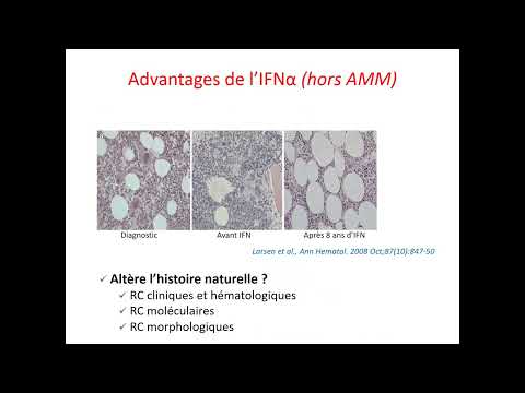 Phase socle 2022-2023 : Polyglobulie de Vaquez - Dr Soret