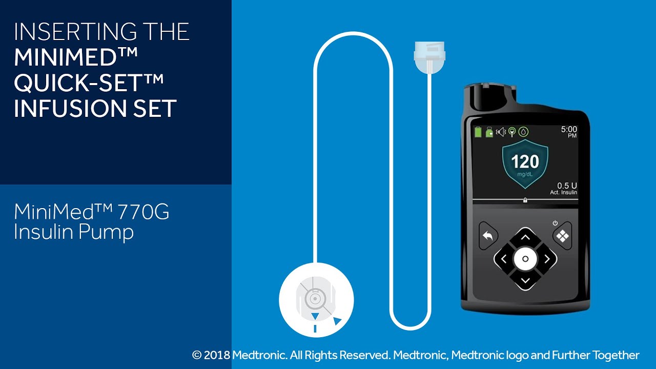 Inserting the Quick-set Infusion Set with the MiniMed™ 770G System