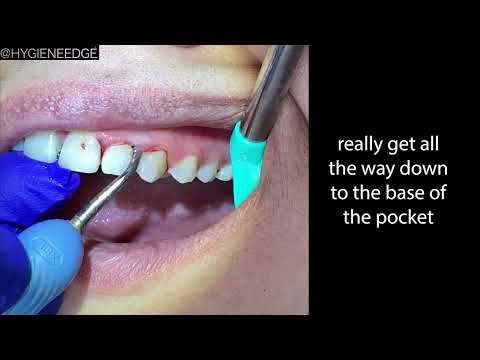 What is Channeling With An Ultrasonic