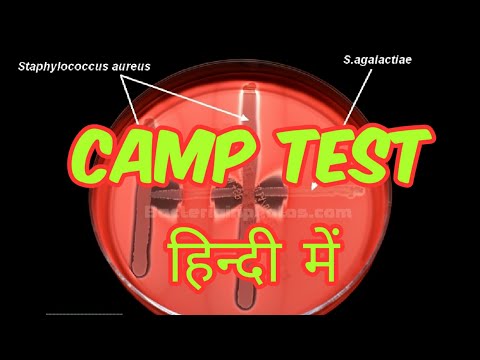 CAMP test (in hindi)