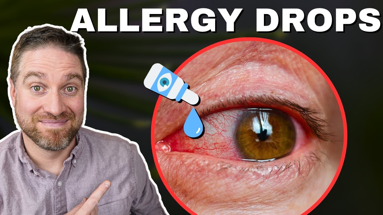 Best Allergy Eye Drops For Red Itchy Eyes! (2025)