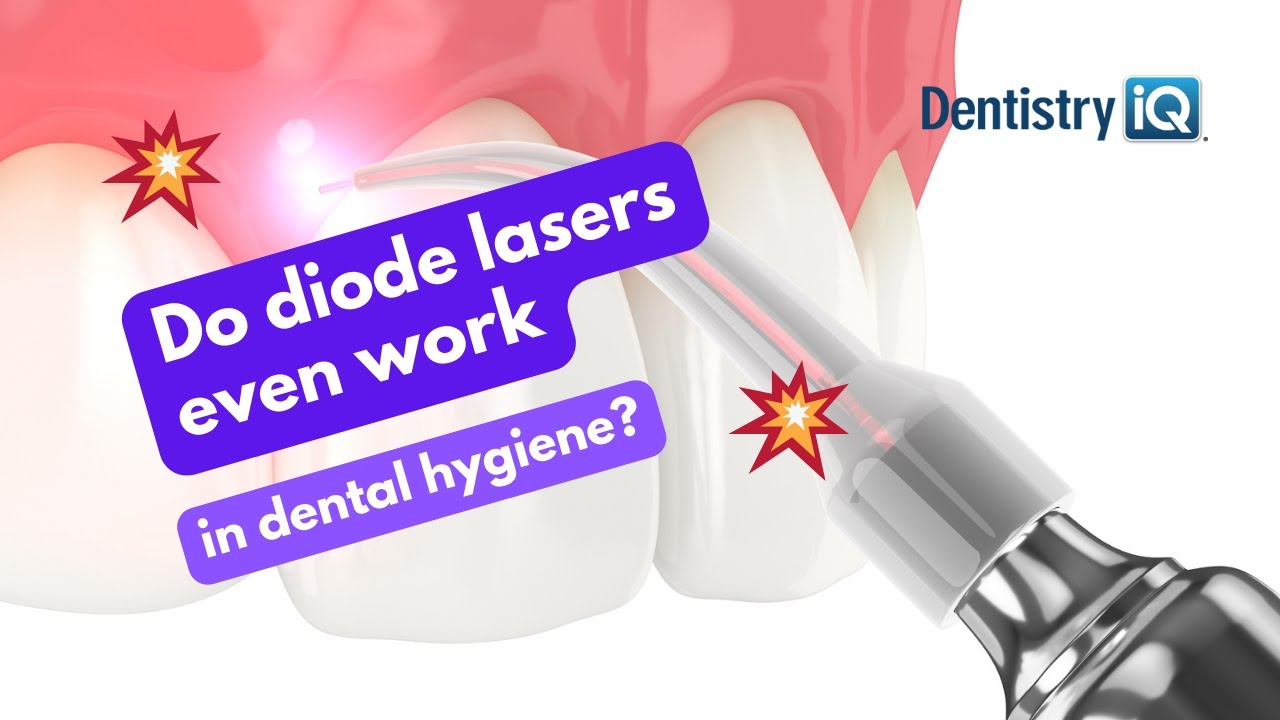 Do diode lasers even work in dental hygiene?
