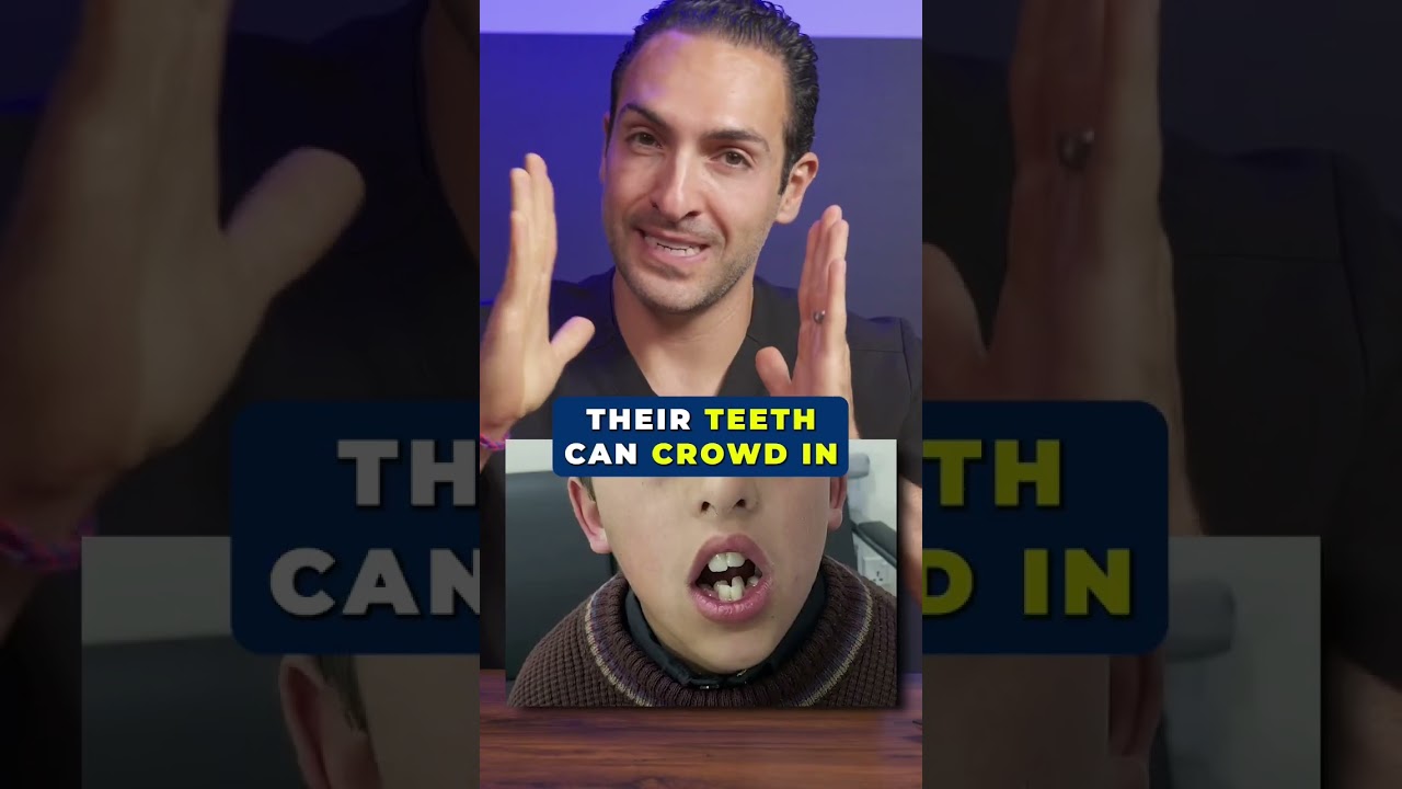 Chronic mouth breathing alters your child's face shape!👶 #longfacesyndrome #adenoidface #entdoctor