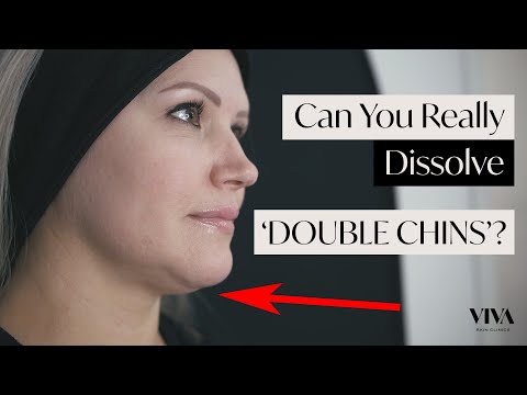Fat Dissolving Injections for your Double Chin Treatment 💫 (Celluform for Submental Fat!)