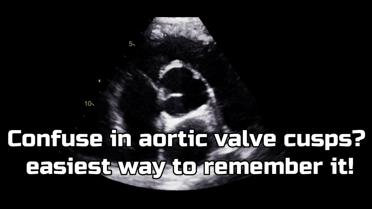 Aortic valve cusps : Label it in easiest way!