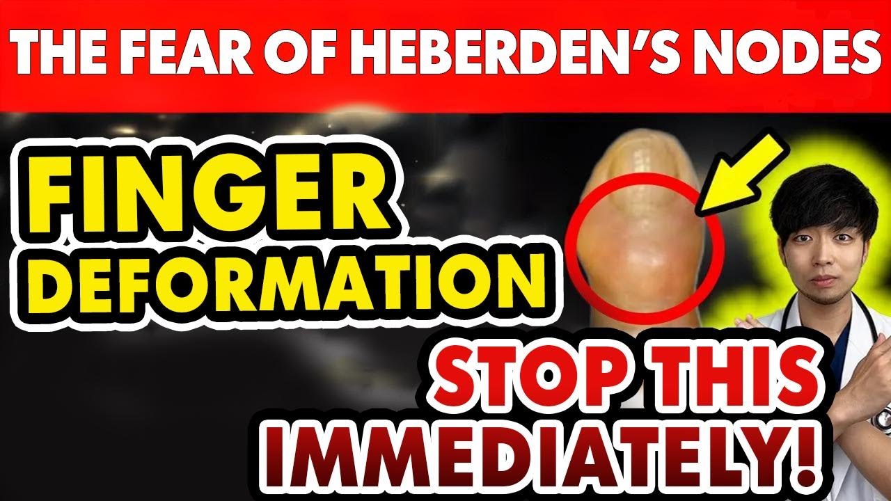 Do You Have Heberden’s Nodes? Know the Symptoms & Fixes