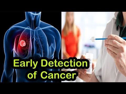 Early detection of male cancer: screening recommendations – Health
