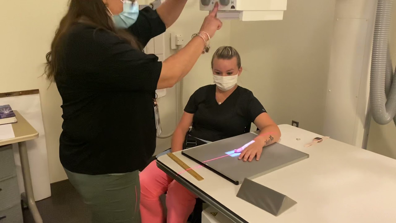 Thumb X-Ray Positioning Video