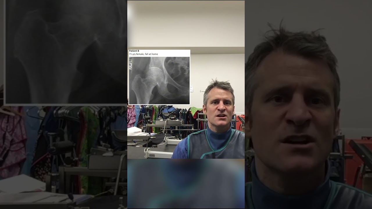 Your Weekend Ortho Content Here #shorts #orthopaedic #orthopaedics