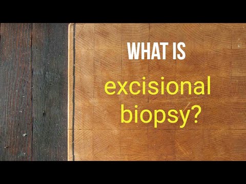 What is excisional biopsy?