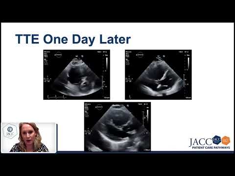 CICU: TTE Interpretation & RV Hemodynamics - JACC PCP | Sudden Respiratory Distress in Pregnancy