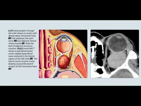 Head and neck radiology diagnostic imaging series images only(4)