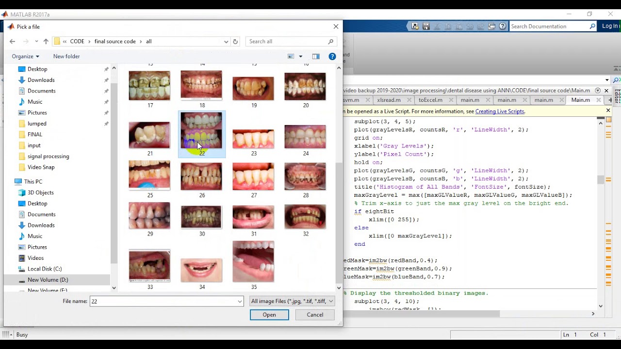 Dental disease detection using deep learning image processing