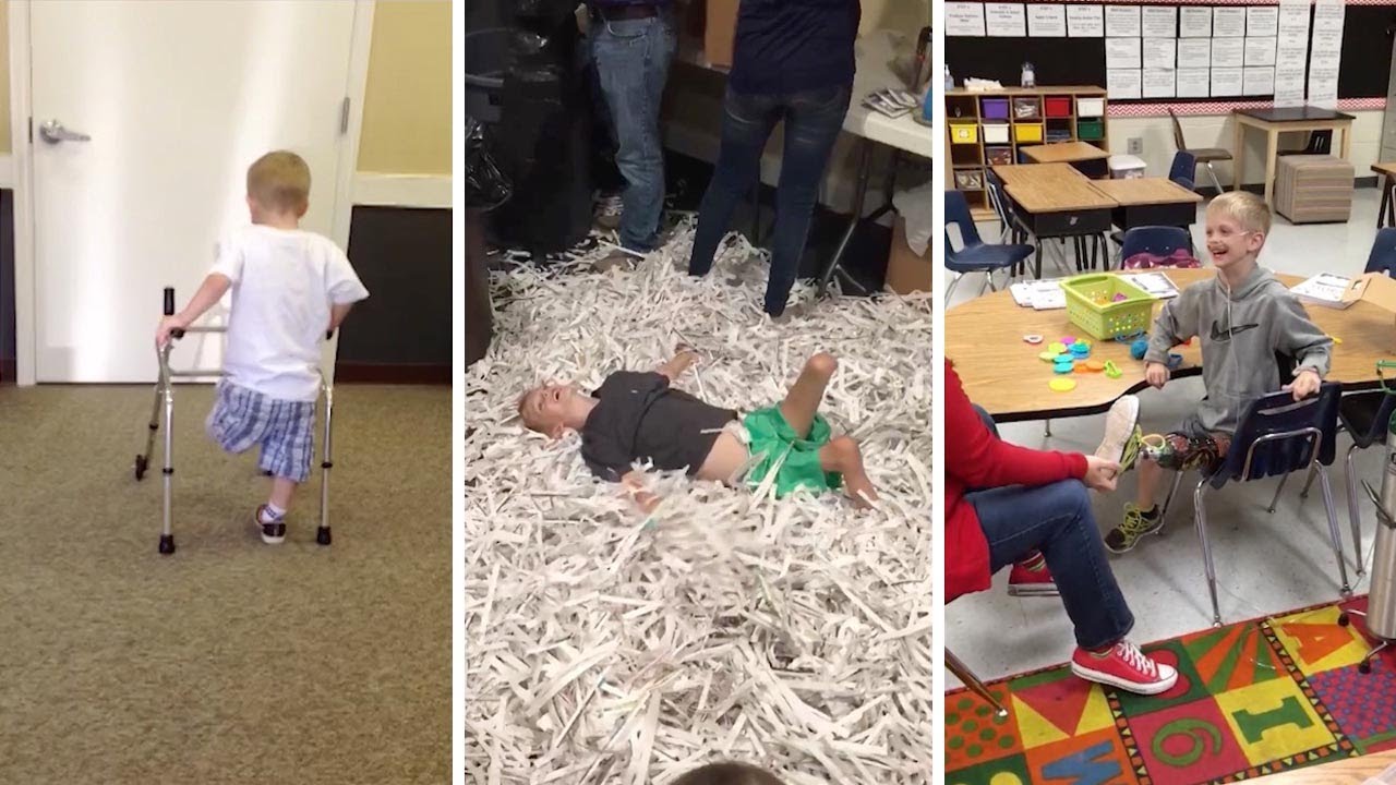 Boy Born With Rare Elephant Man Syndrome