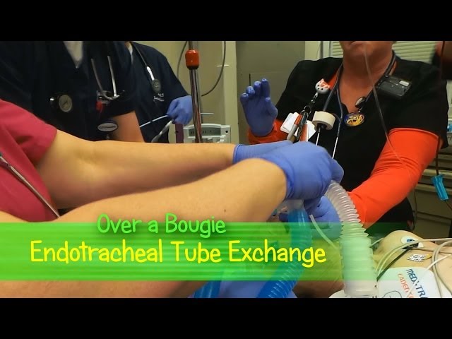 Intubating - ET Tube Exchange Trader - Retailer from Chennai