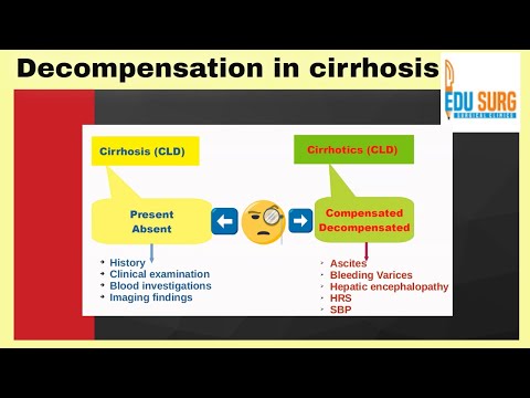 Cirrhosis stages - decompensated cirrhosis - cirrhosis of liver - small talk series