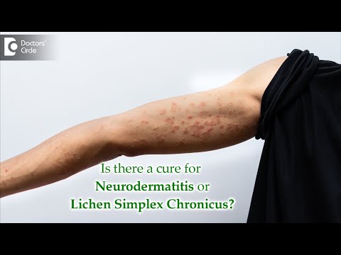 What is Neurodermatitis?: Causes, Symptoms, Diagnosis, Treatment - Dr. Aruna Prasad