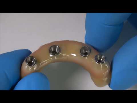 Protesis Dentogingival (FP3) de Zirconio Monolítico