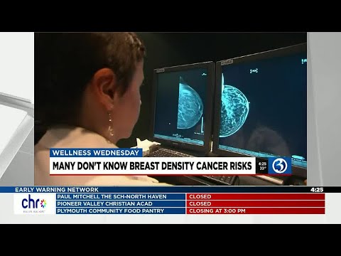WELLNESS WEDNESDAY: Many don't know breast density cancer risks