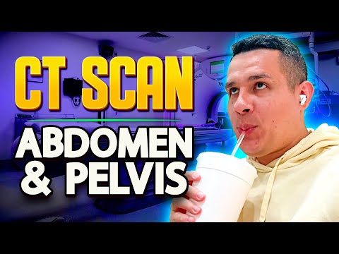 CT Scan Abdomen and Pelvis with Oral Contrast | Vlog