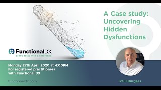 Webinars - Functional DX