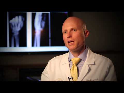 Dr. Froelich talks about Carpal Tunnel Syndrome