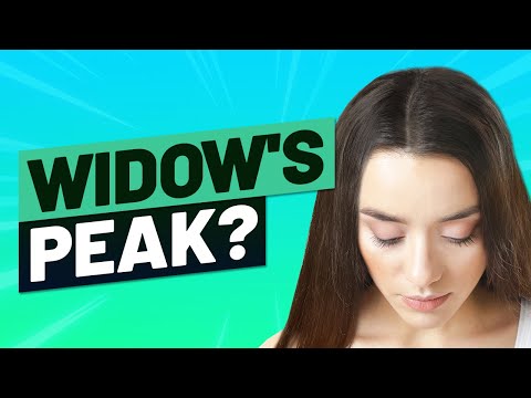 Widow’s Peak Hairline: How To Treat It and What Causes it?