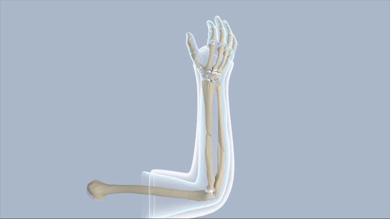 Closed Reduction of a Forearm Fracture