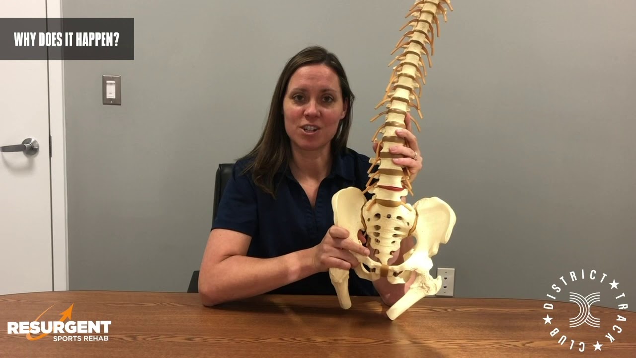 Hip Pain in Runners: Understanding Sacroiliac Joint Dysfunction