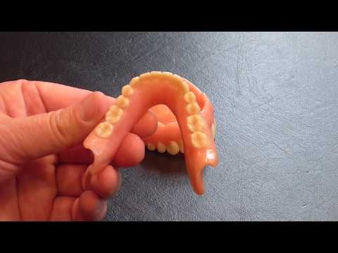 What is a denture?