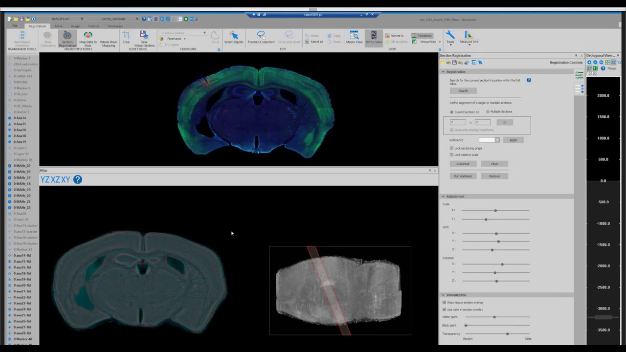 Charting a Course for Brain Mapping — SfN Global Connectome Virtual Event
