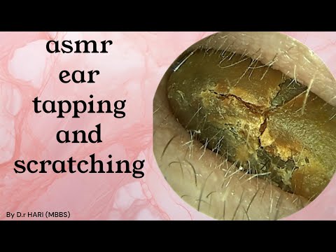asmr ear tapping and scratching || by D.r HARI (MBBS)