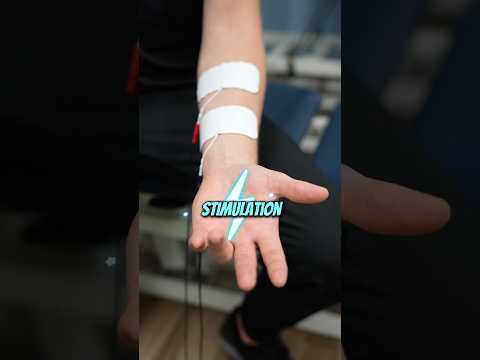 What does electrical stimulation do? ⚡️#physicaltherapy #rehabilitation