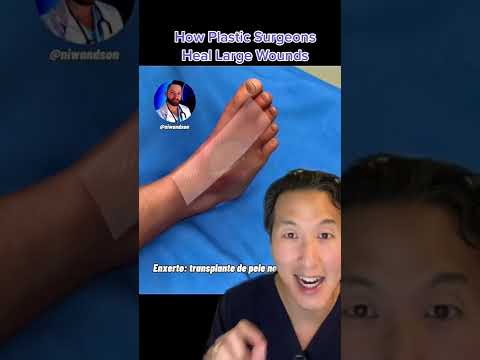 This is How Plastic Surgeons Heal Large Wounds #shorts #skingraft
