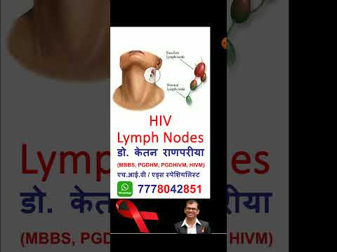 hiv lymph nodes | hiv lymph nodes neck | hiv lymph nodes hindi | acute hiv lymph nodes | #shorts