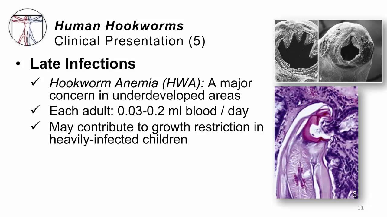 Helminths Hookworms