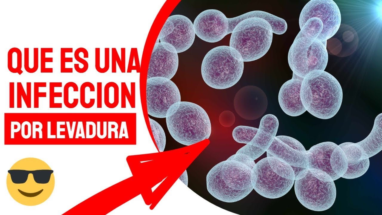 Que Es Una Infección Por Levadura