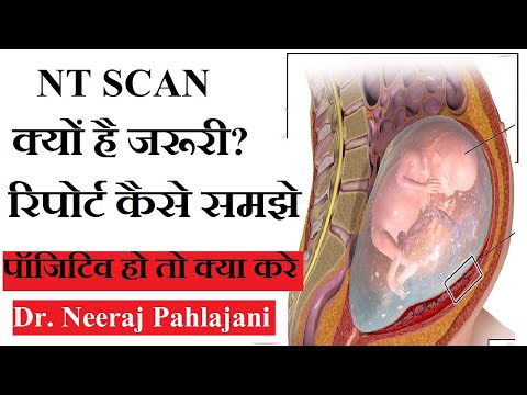NT Scan in Hindi - The most important test of 13 weeks of pregnancy NT Test