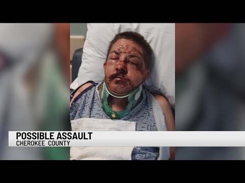 Disabled man says he was robbed, beaten in Cherokee Co., sheriff's office investigating