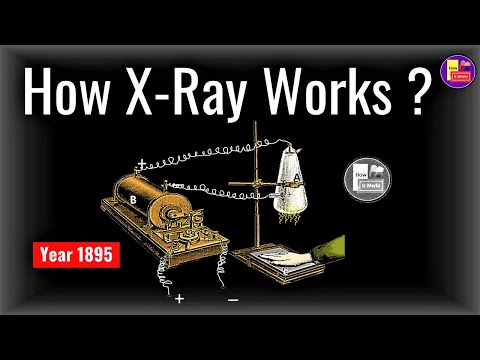 How X-Ray works ? | How X Ray Machine Works ? | How it works ?
