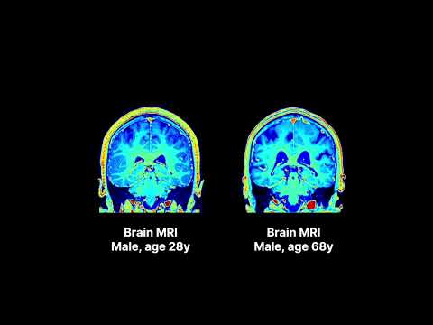 What happens to the brain as we age?