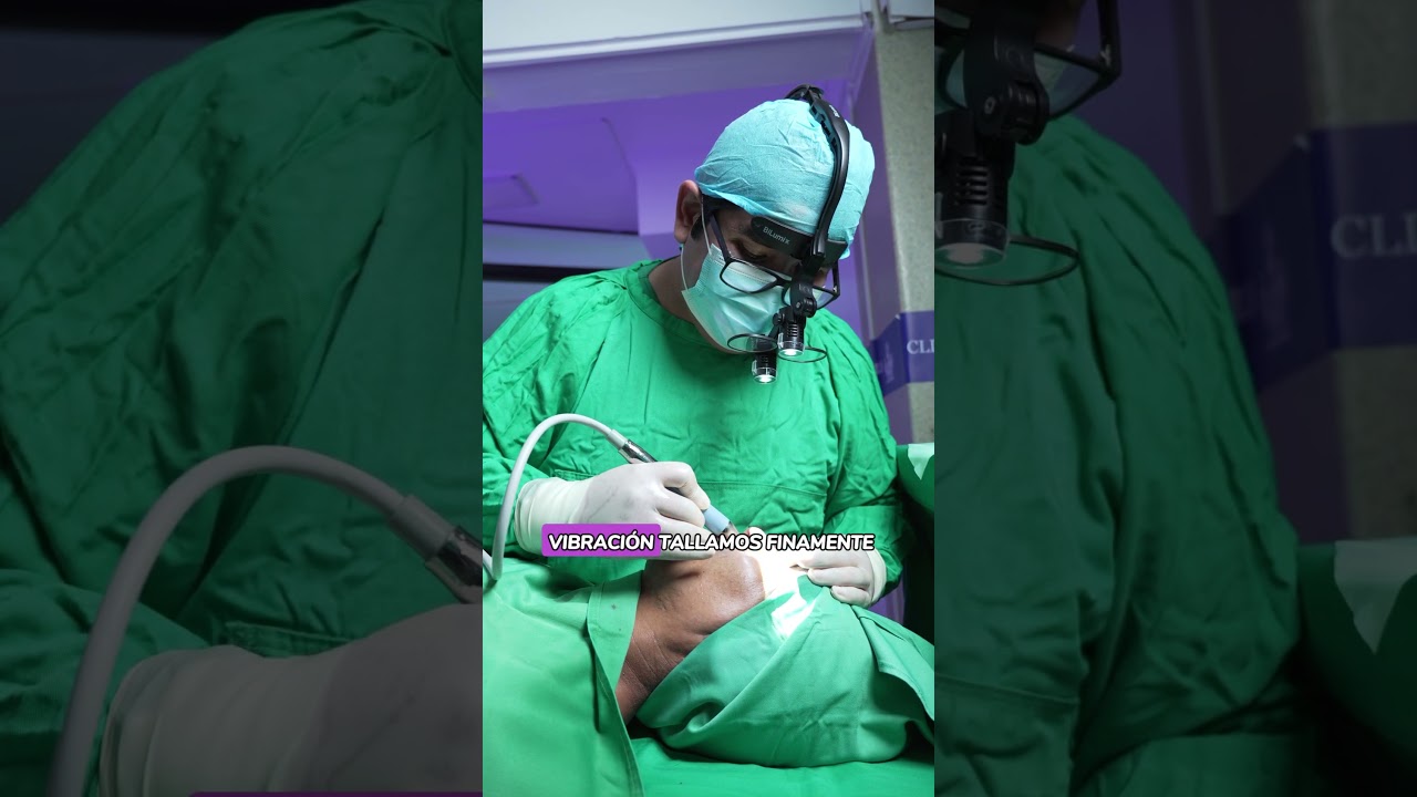 Rinoplastia ultrasónica vs convencional: ¿cuál es mejor? | Dr. Manuel Sinchi