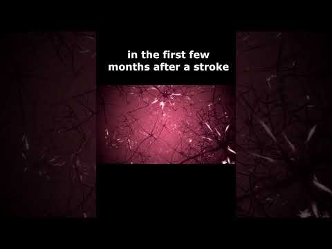 Vision loss after stroke
