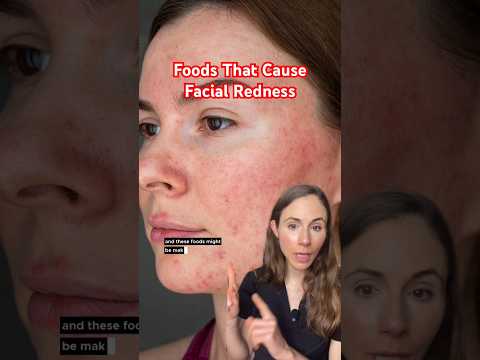 5 Foods That Make Your Face Red