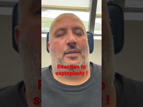 First reaction to septoplasty after splint removal